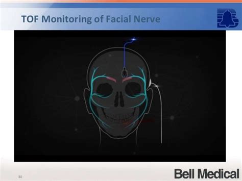Neuromuscular Blocking Agent Monitoring With Stimpod Nms 450 Quantita…