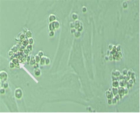 Spermatogonial Stem Cell Colonies Cultured Without Dna And Liposomal Download Scientific