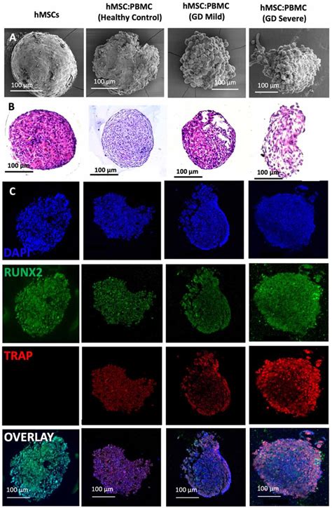 Heterocellular Spheroids 21 Hmscpbmc For Bone Tissue Fabrication As Download Scientific