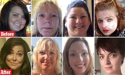 Former Alcoholics Reveal Their Before And After Sobriety Photos On