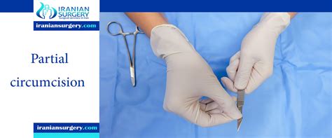 Full Vs Partial Circumcision Partial Circumcision All That You Need
