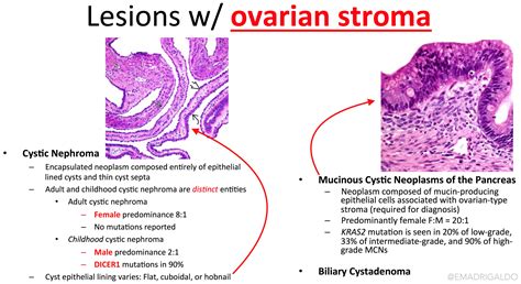 Ovary Stroma Histology