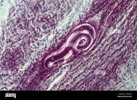 Trichinellaspiralislifecycle