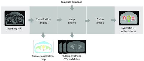 Synthetic Ct Generation Method Overview Of Synthetic Ct Generation Download Scientific Diagram