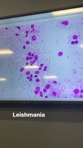 Lab Flashcards Quizlet