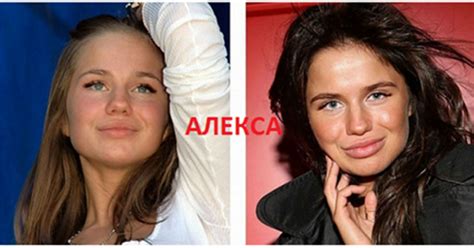 10 Российских Милашек Убивших Свою Красоту Чрезмерной Пластикой