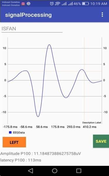 VEP Signal Plot Displayed On Mobile Application P Latency Was Download Scientific Diagram