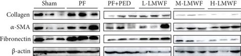 Assessment Of Pulmonary Fibrosis Immunohistochemical Detection Of
