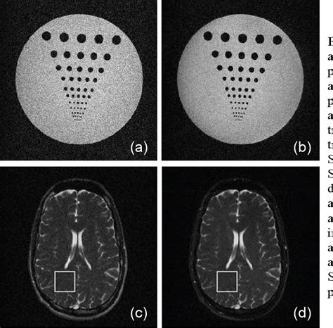 Figure 12 From Continuous Sampling In Magnetic Resonance Imaging Semantic Scholar