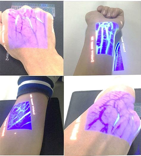 portable vein viewer locator detector trans illuminator visualization