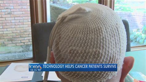 Electrode Skullcap Shows Promise Fighting Brain Cancer Youtube