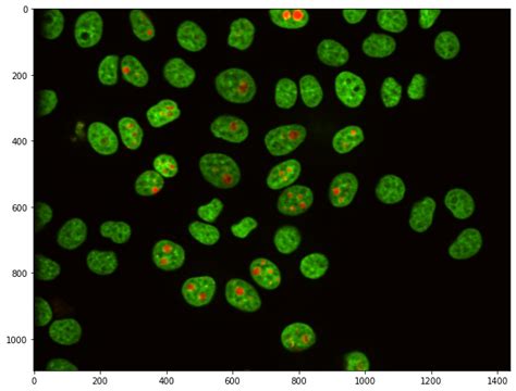 U Net Model Implementation And Sam Segment Anything Model Exploration