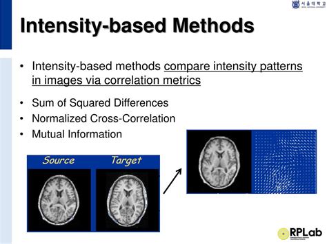 Ppt Tuesday Seminar Deformable Image Registration Powerpoint