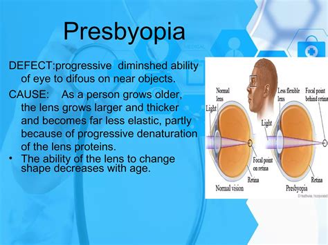 Accommodationreflexesdefects Of Vision Ppt