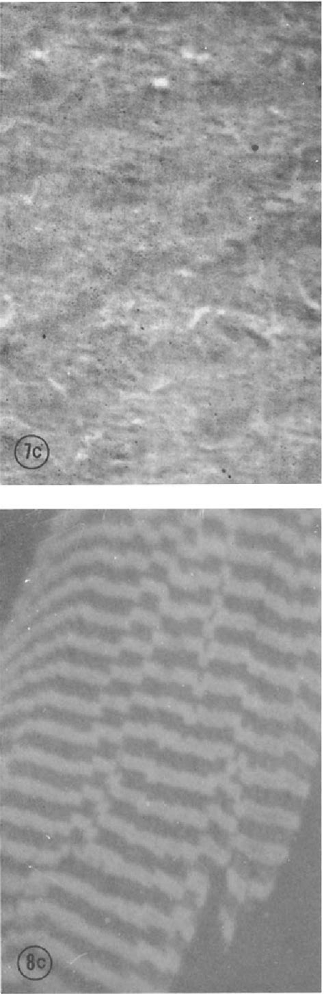 Figure 85 From The Use Of Specific Antibody In Electron Microscopy Semantic Scholar