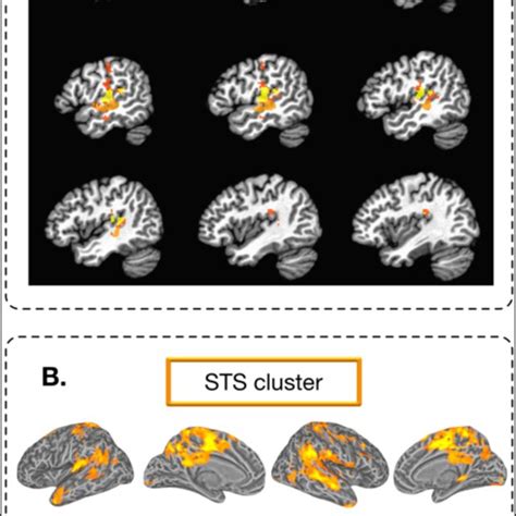 Changes In Connectivity Structure Of Lateral Temporal Cortex During Download Scientific Diagram
