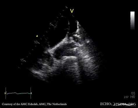 Filee00743 Echopedia