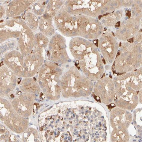 Rabbit Polyclonal Anti Mst1 Antibody Buy For Research Highly