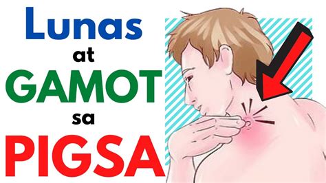 Nakakahawa B Ang Pigsa