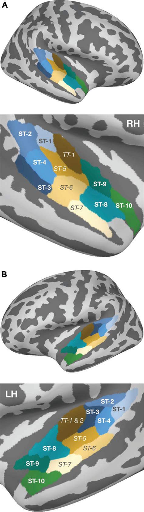 Frontiers Neuromagnetic Representation Of Melodic Contour Processing