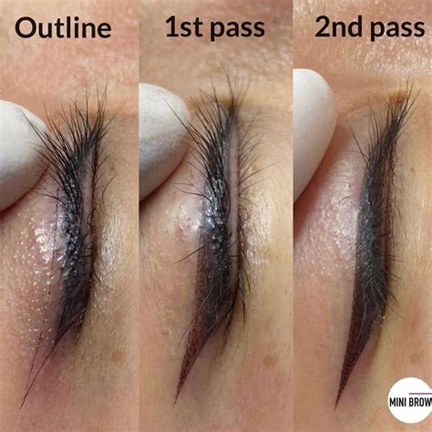 Permanent Eyeliner Before And After Pics 2024 Best Works