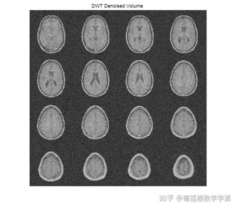 双树复小波变换dual Tree Complex Wavelet Transform在信号处理中的应用 Csdn博客
