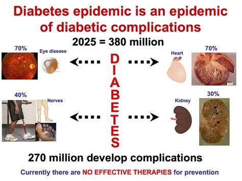 Complications Of Diabetes