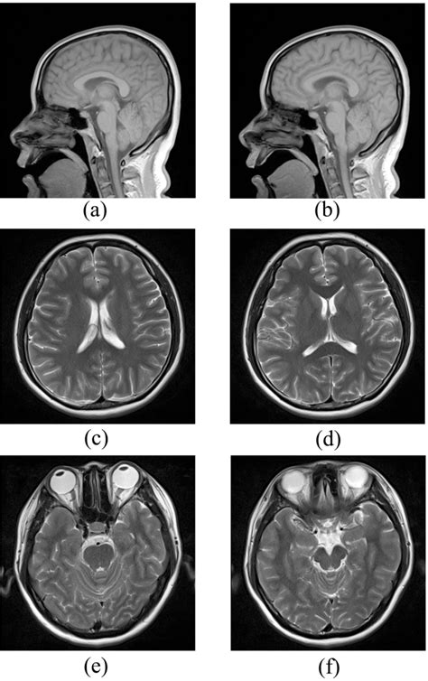 Figure 3 From Reference Driven Compressed Sensing Mr Image Reconstruction Using Deep