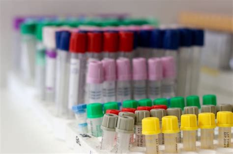 How Lis Can Optimize Laboratory Workflows [infographic] Aspyra