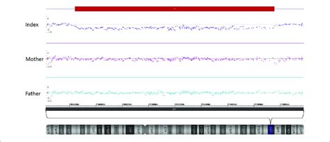 Snp Array Analysis Of The Patient Identified A Microdeletion In The