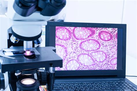 Ai In Cancer Therapy Using Prostate Cancer Biomarkers Arteraai