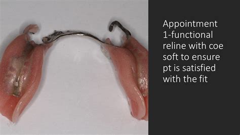 How To Plan And Execute A Partial Denture Reline And Repair Dr