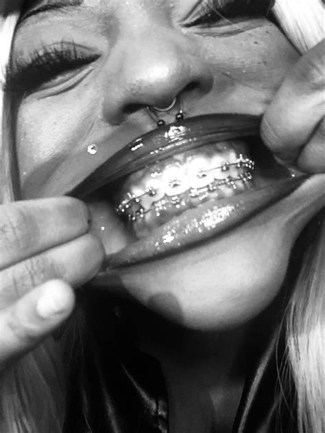 Pin By Donna Jean On 2025 Vision Board Teeth Aesthetic Silver Braces