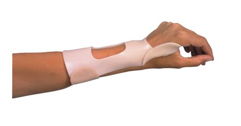 Splint In The Spotlight The Dorsal Wrist Cock Up Orthosis Orfit