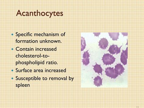 Ppt Mlab 1415 Hematology Keri Brophy M Artinez Powerpoint