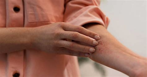 Doxycycline Side Effects Risks And Precautions Explained