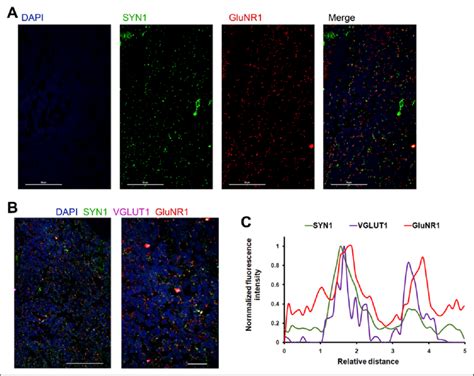 Synapse Analysis Using Double And Triple Staining For Syn1 Glunr1 And