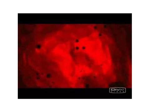 Severe Acute Respiratory Syndrome Ppt Infectious Diseases