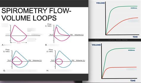 Diagram Of Spirometry Interpretation Quizlet