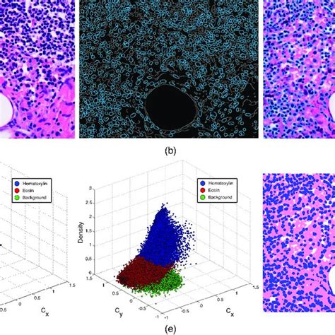 Illustration Of The Classification Steps A Sample Image Of A Lymph
