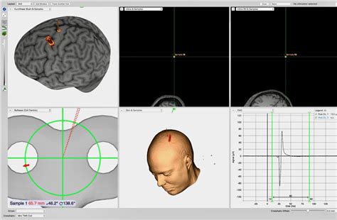 Transcranial Magnetic Stimulation Center For Brain Science
