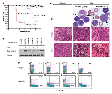 Figure 3 From Cbf B Reduces Cbf B Smmhcassociated Acute Myeloid Leukemia In Mice Semantic