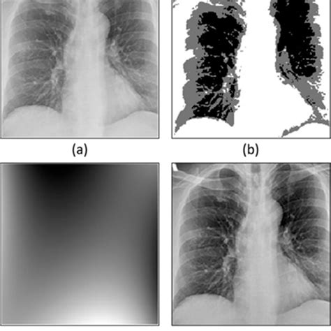 Application Of Bias Field Correction Of The X Ray Image A Original Download Scientific