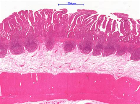 Diagram Of GI Tract Ileum Quizlet