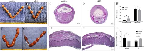 Arid1a Cko Mice Showed Increased Embryo Resorption During The Third