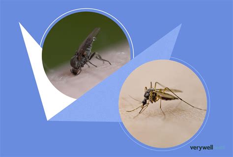 Mosquito Bites Vs Sand Fly Bites What To Know About Leishmaniasis Risk