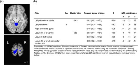 Ab Significant Whole Brain Activation For The Contrast Unsupported