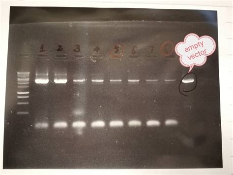 103 Questions With Answers In Gateway Cloning Science Topic