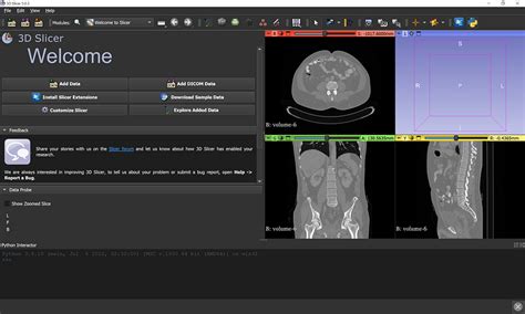 Software To Visualizeannotate Dicomnifti Files Pycad