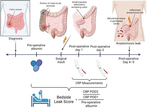 Frontiers A Novel Scoring System For The Early Detection Of